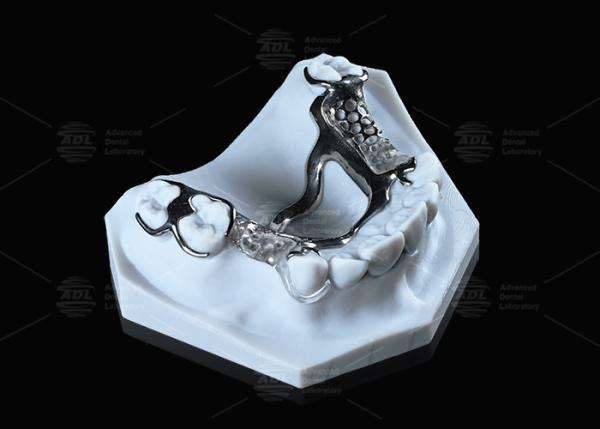Quality High Strength 3D Printed Titanium Framework With Clear Clasps For Durable for sale