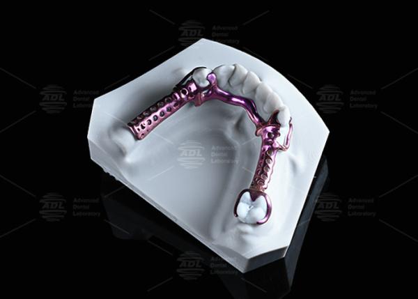Quality Anodized 3D Titanium Framework High Strength And Lightweight And Adjustable for sale
