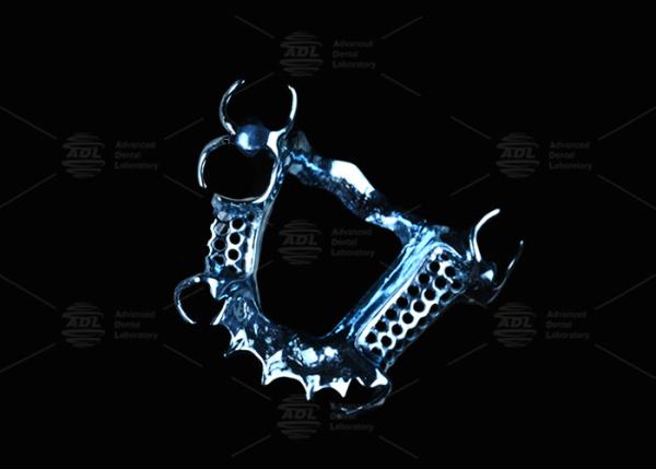 Quality Hypoallergenic Adjustable And Customizable 3D Printed Titanium Framework With for sale