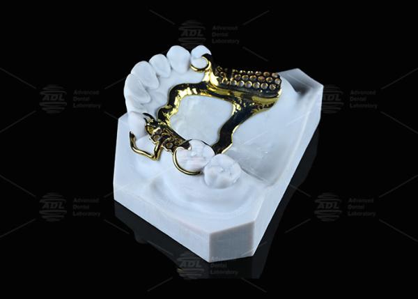 Quality Corrosion Resistant Printed Titanium Framework Sensitive Skin for sale