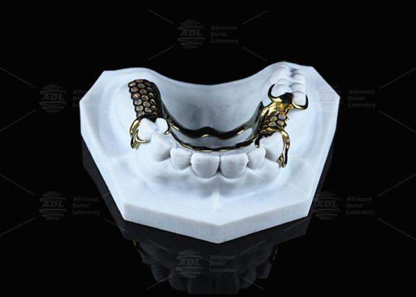 Quality Corrosion Resistant Printed Titanium Framework Sensitive Skin for sale