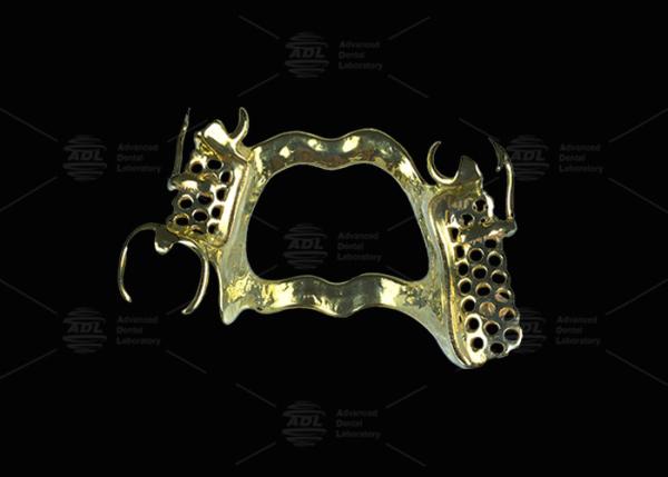 Quality Corrosion Resistant Printed Titanium Framework Sensitive Skin for sale