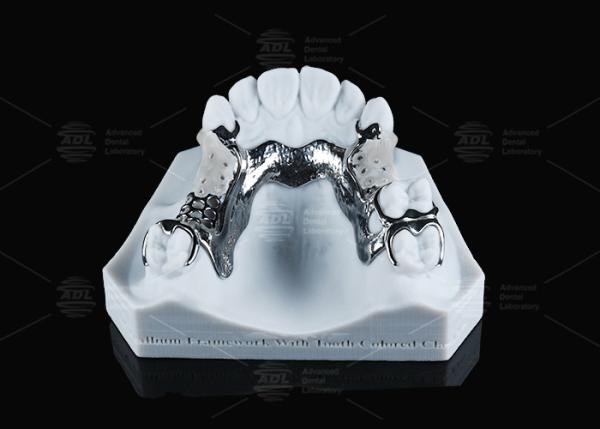 Quality FDA Vitallium Framework With Tooth Colored Clasps For Natural Esthetics for sale