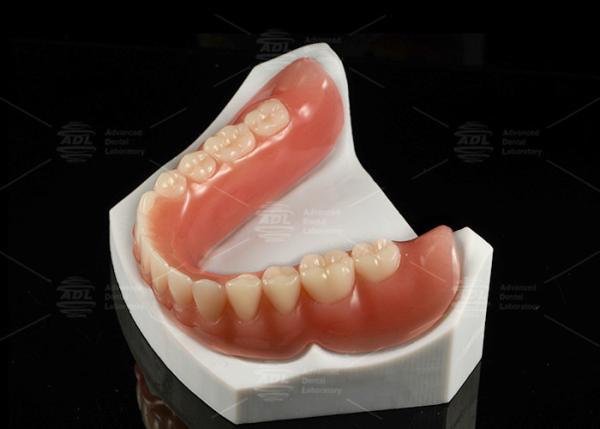 Quality High Esthetics Removable Full Acrylic Denture Acrylic Complete Denture for sale