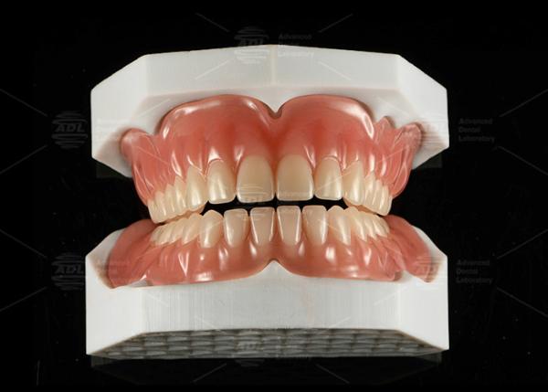 Quality High Esthetics Removable Full Acrylic Denture Acrylic Complete Denture for sale