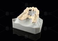quality Digital Denture supplier