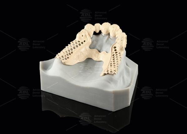 Quality Milled Peek Framework Customizable Digital Partial Dentures Superior Thin for sale