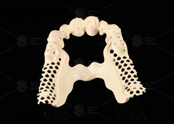 Quality Milled Peek Framework Customizable Digital Partial Dentures Superior Thin for sale