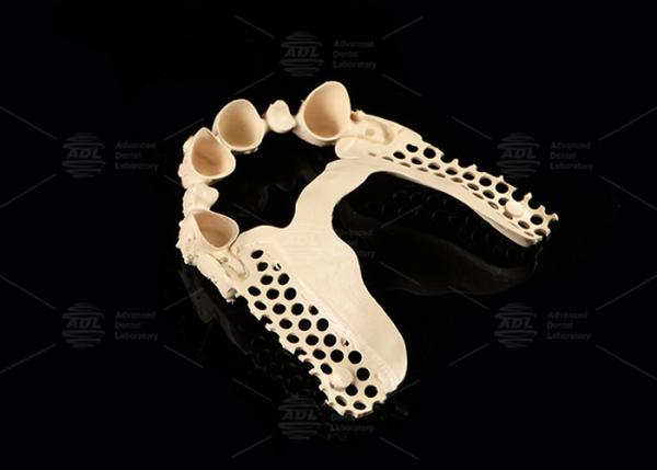 Quality Milled Peek Framework Customizable Digital Partial Dentures Superior Thin for sale