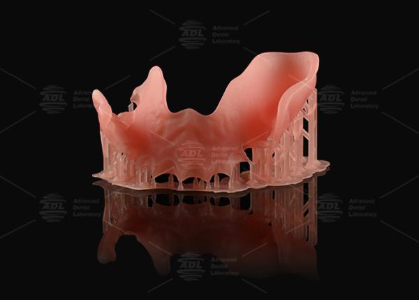 Quality Orange Pink Acrylic Partial Denture Natural Looking 3d Printing Digital Dentures for sale