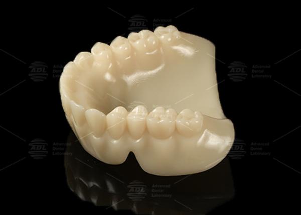 Quality 3D Printed Dentures Try In Bio Compatible A1/A2/A3 Perfect Fit And Occlusion for sale
