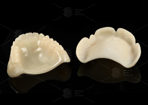 Quality 3D Printed Dentures Try In Bio Compatible A1/A2/A3 Perfect Fit And Occlusion for sale