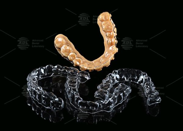 Quality Customizable Invisible Aligner Clear Aligner With Shorter Treatment Time for sale