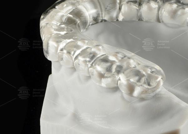 Quality Clear Hard Soft Night Guard Breathability Heavy Duty Protection Occlusal Splint for sale