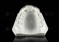 Quality Hard Occlusal Splint Dental For Jaw Pain Relief Protection Oral Splint for sale