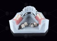 Quality CEKA M2 Precision Attachment Titanium With 3mm Horizontal / Vertical Clearances manufacturer