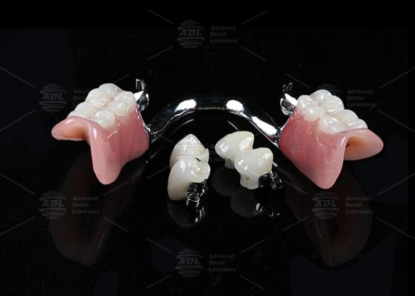 Quality Adjustable Multi Functional ERA Precision Attachment Removable ERA Attachments for sale