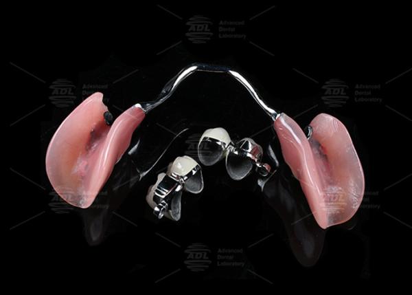 Quality Adjustable Multi Functional ERA Precision Attachment Removable ERA Attachments for sale