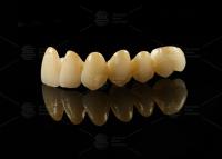 Quality Strong Aesthetic Porcelain Fused To Zirconia For Natural Looking Restorations manufacturer