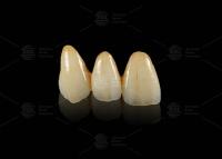 Quality Durable Hypoallergenic EMAX Bridge Extreme Esthetics Emax Dental Bridge manufacturer