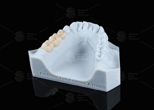 Quality Translucency White Full Contour Zirconia Crown FCZ Monolithic Zirconia Crown for sale