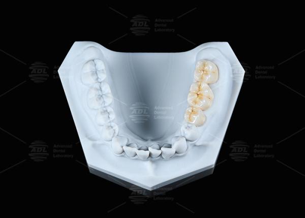 Quality Translucency White Full Contour Zirconia Crown FCZ Monolithic Zirconia Crown for sale