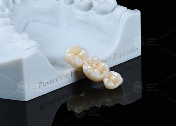 Quality Translucency White Full Contour Zirconia Crown FCZ Monolithic Zirconia Crown for sale