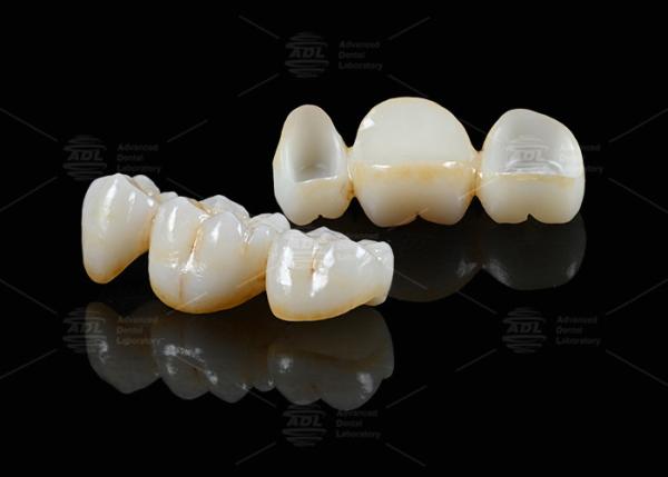 Quality Translucency White Full Contour Zirconia Crown FCZ Monolithic Zirconia Crown for sale