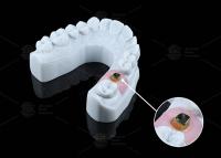 Quality Customized Titanium Base Corrosion Resistance Dental Implants And Solutions manufacturer