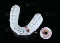 Quality Internal Hex Custom Titanium Abutment Screw Cement Retained Varying Shape manufacturer