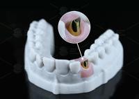 China Internal Hex Custom Titanium Abutment Screw Cement Retained Varying Shape for sale