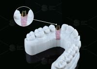 China Internal Hex Custom Titanium Abutment Screw Cement Retained Varying Shape for sale