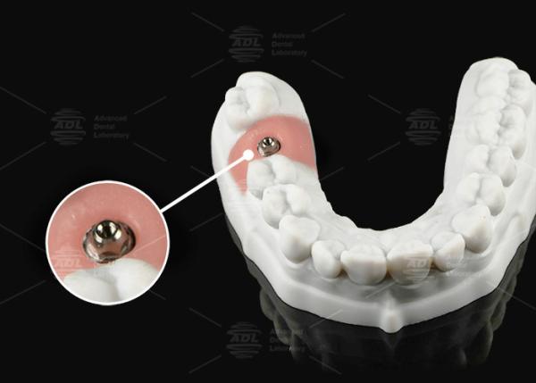 Quality Silver Gold Titanium Multi Unit Abutment For Single Or Multi Unit Prosthetic for sale