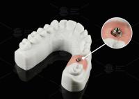China Silver Gold Titanium Multi Unit Abutment For Single Or Multi Unit Prosthetic Platform for sale