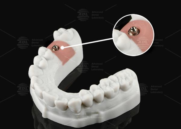 Quality Silver Gold Titanium Multi Unit Abutment For Single Or Multi Unit Prosthetic for sale