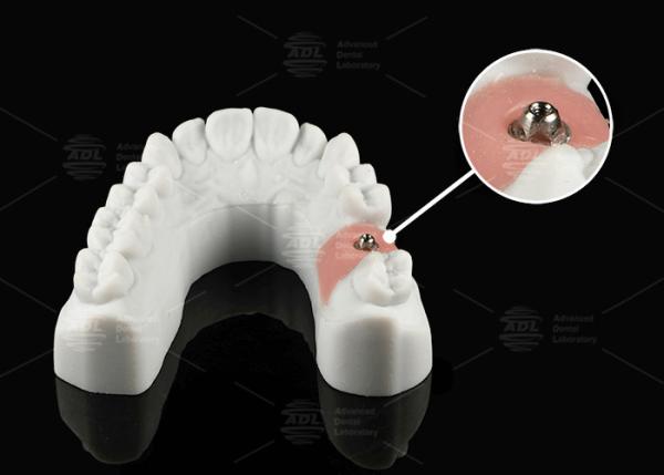 Quality Silver Gold Titanium Multi Unit Abutment For Single Or Multi Unit Prosthetic for sale