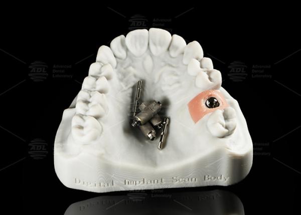 Quality Precision Titanium Digital Implant Scan Body Sandblasted Surface For Cad/Cam for sale