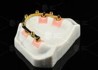 quality Implant Bar supplier