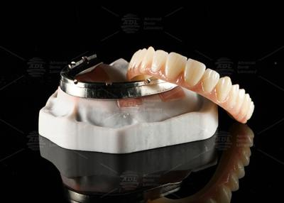 Translucent Full Contour Zirconia Bridge Over Milled Implant Bar Customized Design