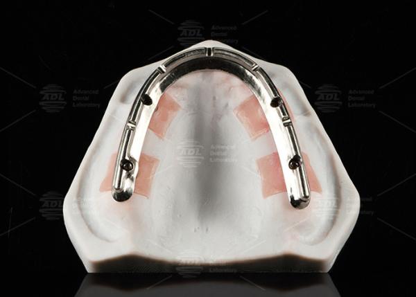 Quality Translucent Full Contour Zirconia Bridge Over Milled Implant Bar Customized for sale