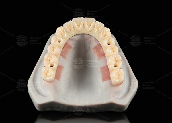 Quality Translucent Full Contour Zirconia Bridge Over Milled Implant Bar Customized for sale