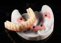 Quality Composite Pink Porcelain Crown A1 Shade All On 4 Hybrid Titanium Screw Retained manufacturer