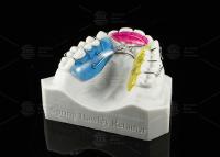 Quality Customizable Spring Hawley Retainer Removable Teeth Position Retention manufacturer