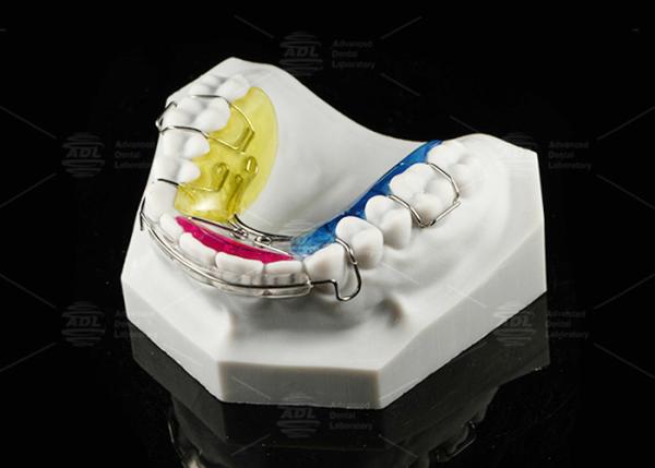 Quality Customizable Spring Hawley Retainer Removable Teeth Position Retention for sale