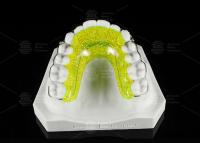 Quality Custom Fit BEGGS RETAINER Orthodontic For Teeth Alignment Easy To Clean manufacturer