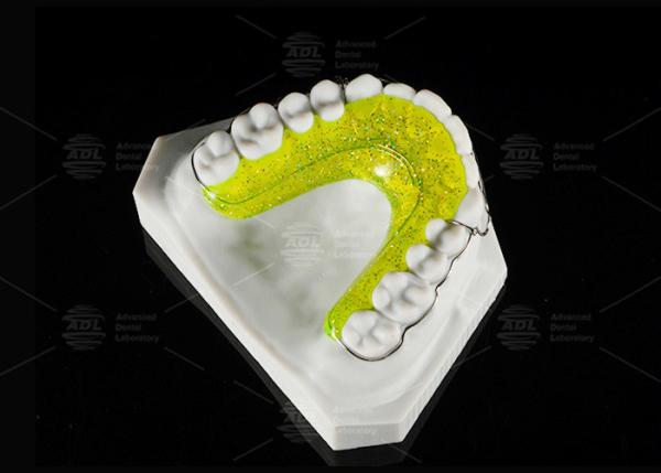 Quality Custom Fit BEGGS RETAINER Orthodontic For Teeth Alignment Easy To Clean for sale
