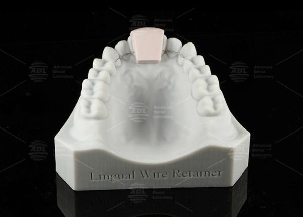 Quality Non Removable Lingual Wire Retainer Invisible Direct Bonded Lingual Retainer for sale