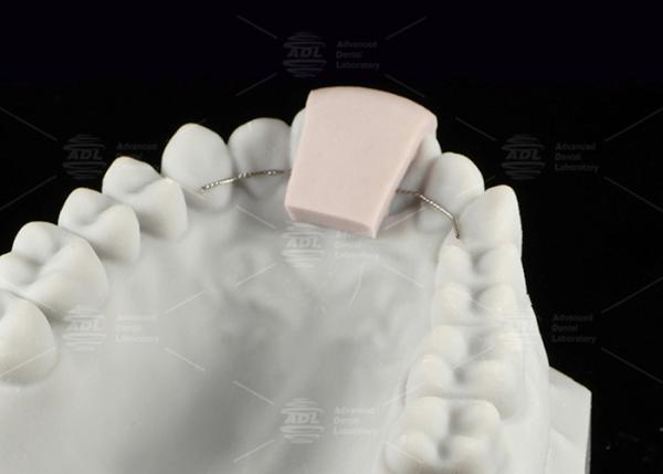 Quality Non Removable Lingual Wire Retainer Invisible Direct Bonded Lingual Retainer for sale