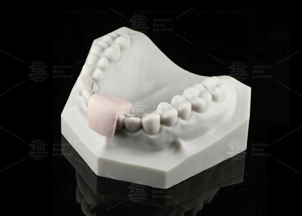 Quality Non Removable Lingual Wire Retainer Invisible Direct Bonded Lingual Retainer for sale
