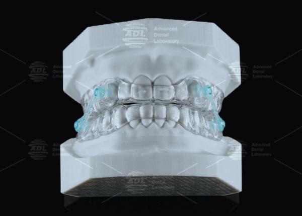 Quality Transparent Erkodent Silensor Anti Snoring Mouthpiece Custom Fit Noise Reduction for sale